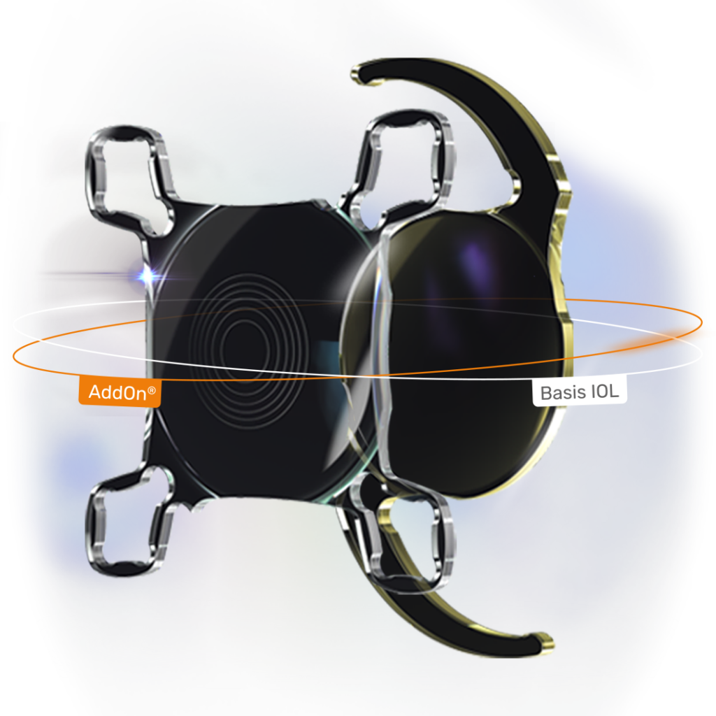 1stQ - Leading IOL Solutions