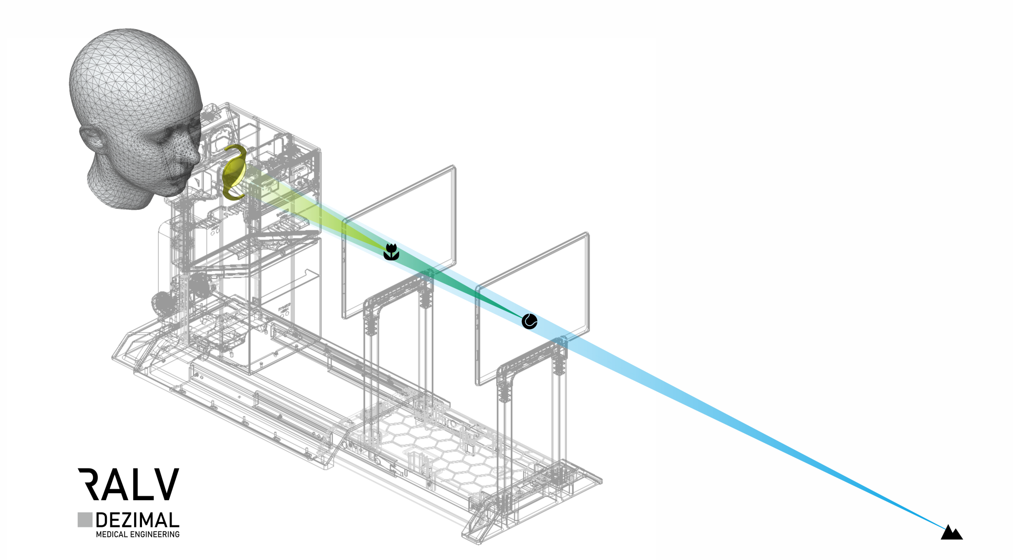 RALV Technology - 1stQ